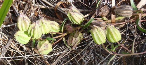 Melasma - PictureThis